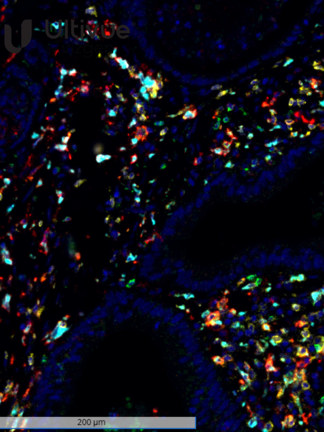 Stronger Together - Ultivue